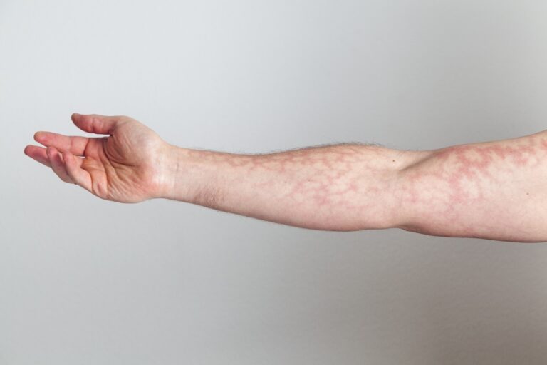 Home Blood Circulation Check Methods in Phoenix, AZ